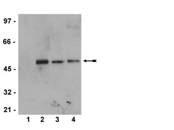 MAPK Pathway 1 Explorer Antibody MiniPack | 15-107